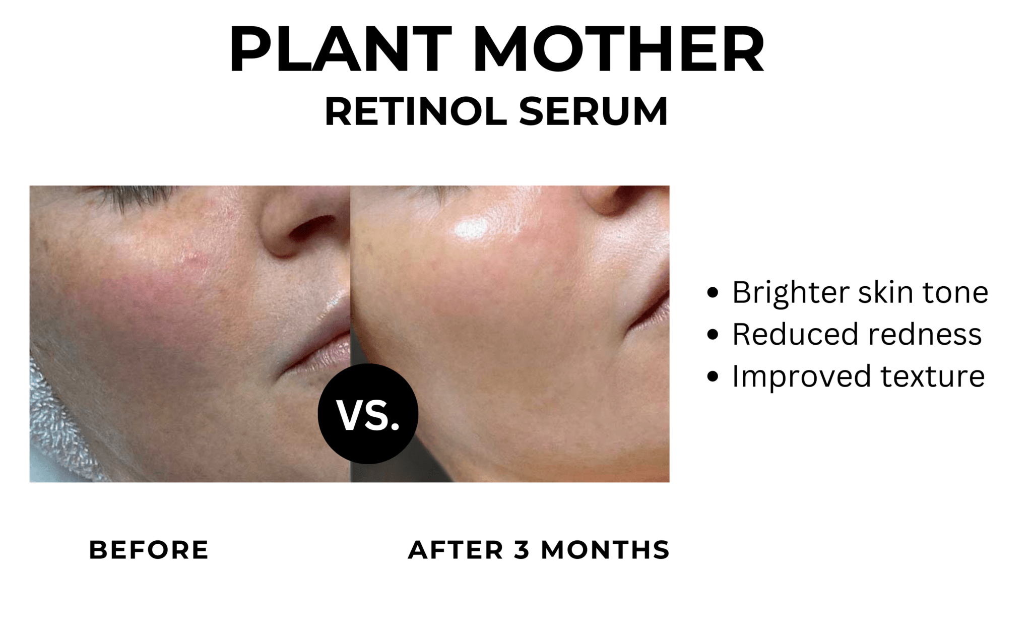 100% Organic Plant-Based Retinol Serum – Plant Mother