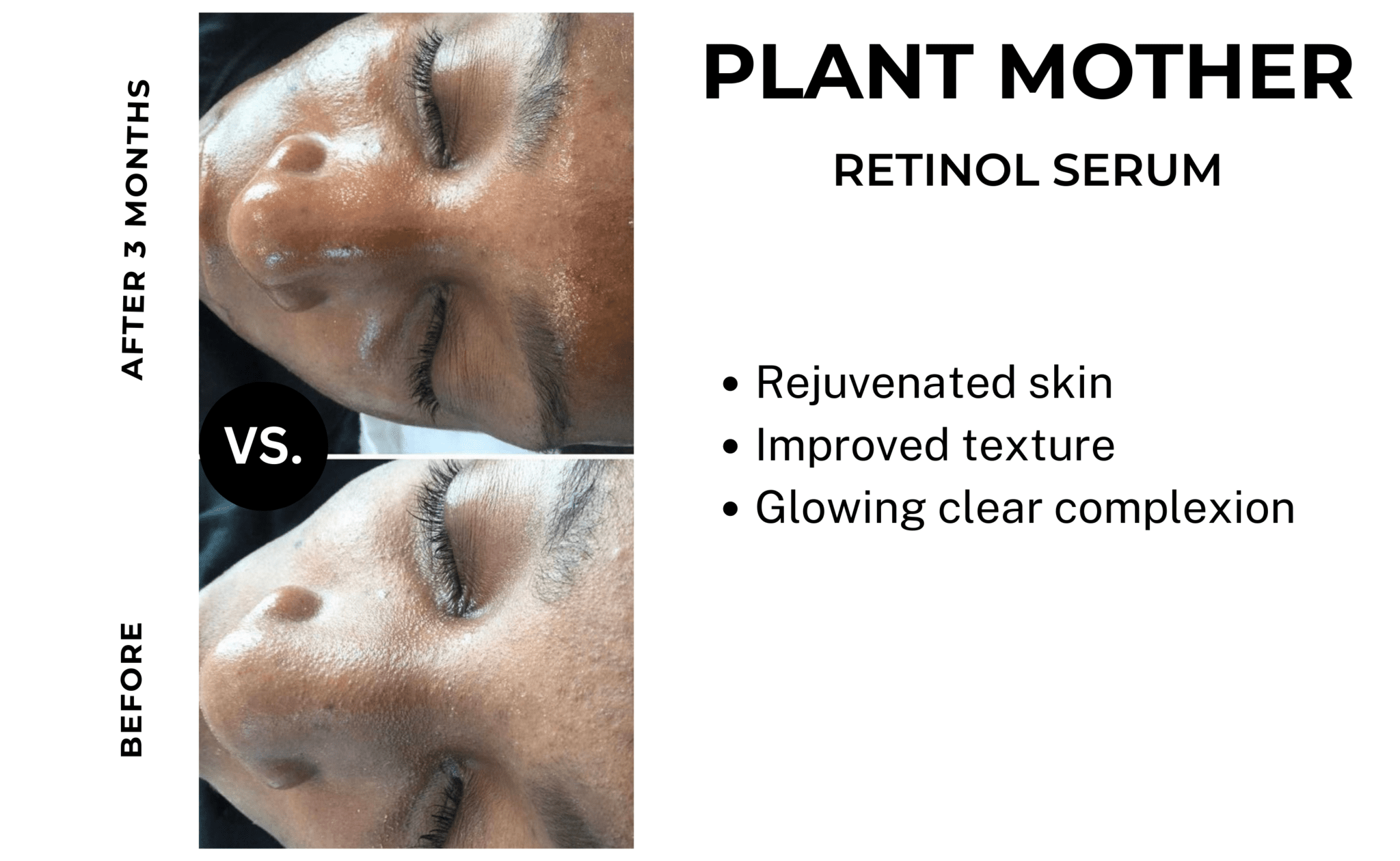 Retinol Serum - Organic Plant Based Serum - Rich In Nutrients & Vitamins