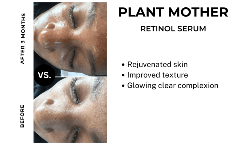 Retinol Serum - Organic Plant Based Serum - Rich In Nutrients & Vitamins